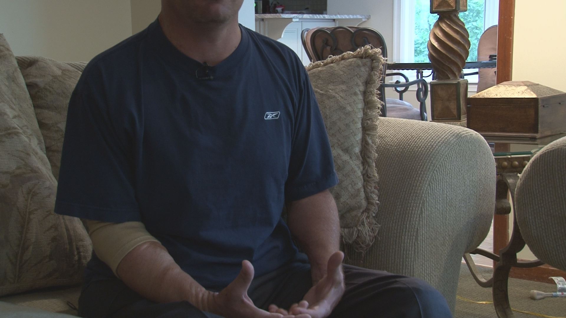 WARNING, GRAPHIC | Burn victim has message for 'Fire Challenge' takers ...