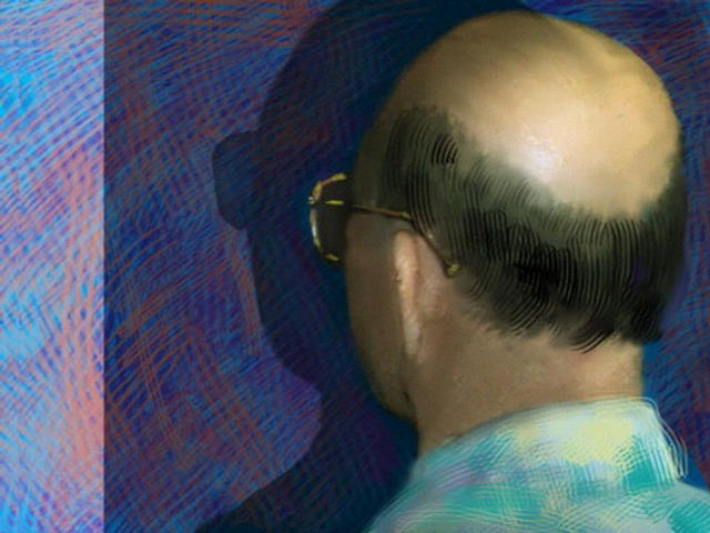 Police scratching heads over bald man who's stealing Rogaine | wkyc.com