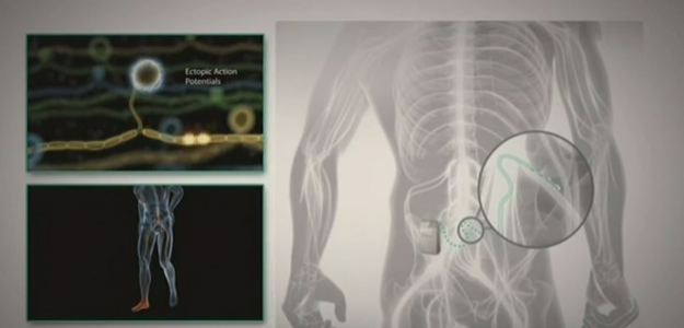Timothy Lubenow & Denise Zuhn – New Solutions to Provide Chronic Pain ...